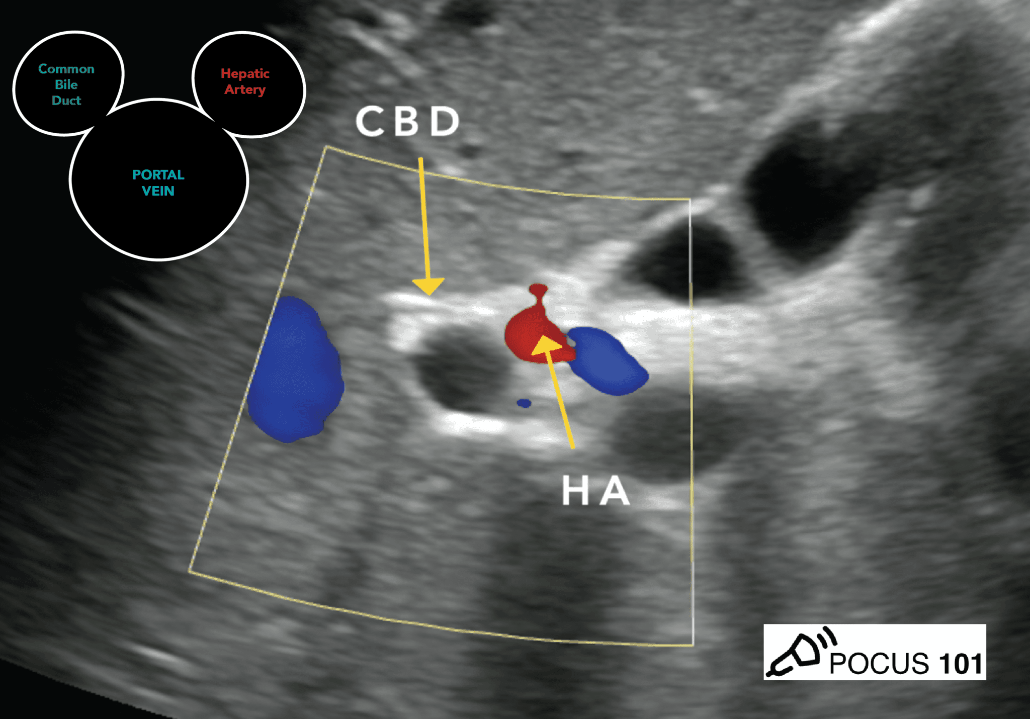 Abdominal Ultrasound Made Easy Step By Step Guide Pocus 101
